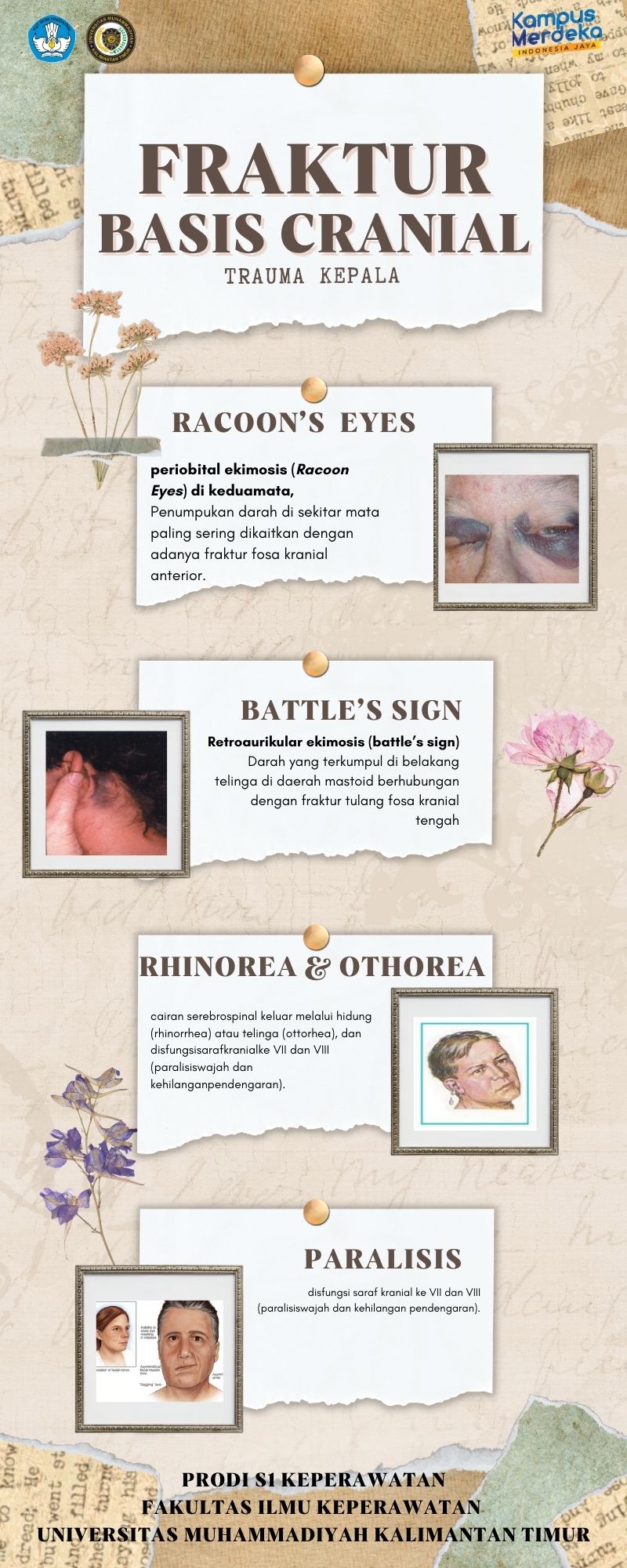 KGD II: INFOGRAFIS : FRAKTUR BASIS CRANIAL | LMS-SPADA INDONESIA